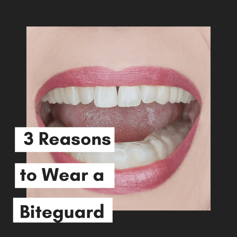 3 Reasons to Wear a Biteguard | Southwest Family Dentistry