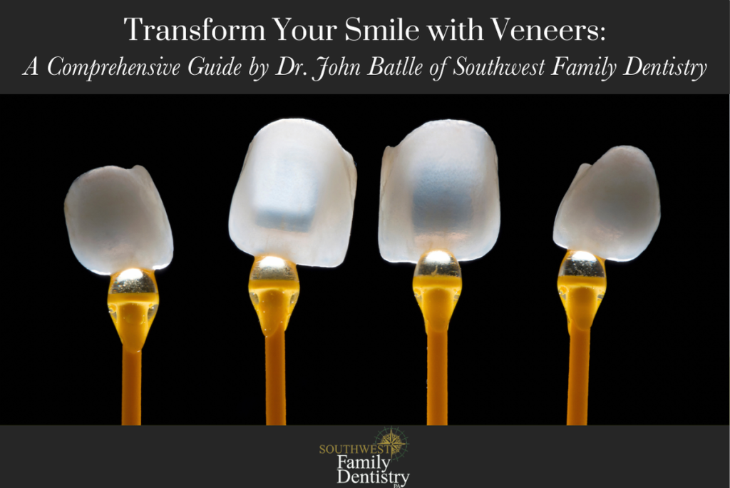 Transform Your Smile with Veneers: A Comprehensive Guide | Southwest Family Dentistry